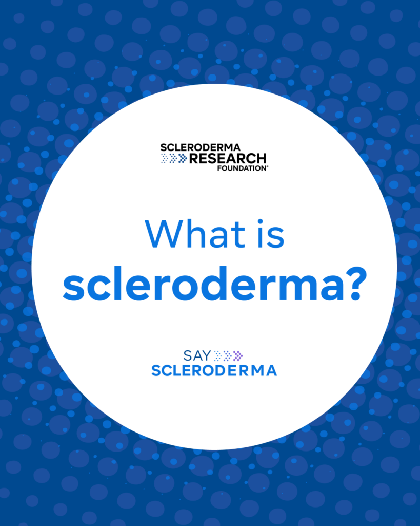 What Is Scleroderma? | Scleroderma Research News and Updates ...